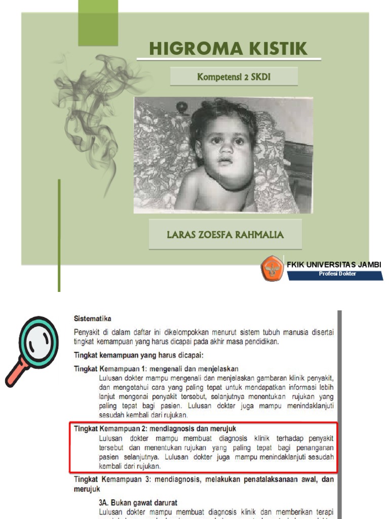 Higroma Kistik | PDF
