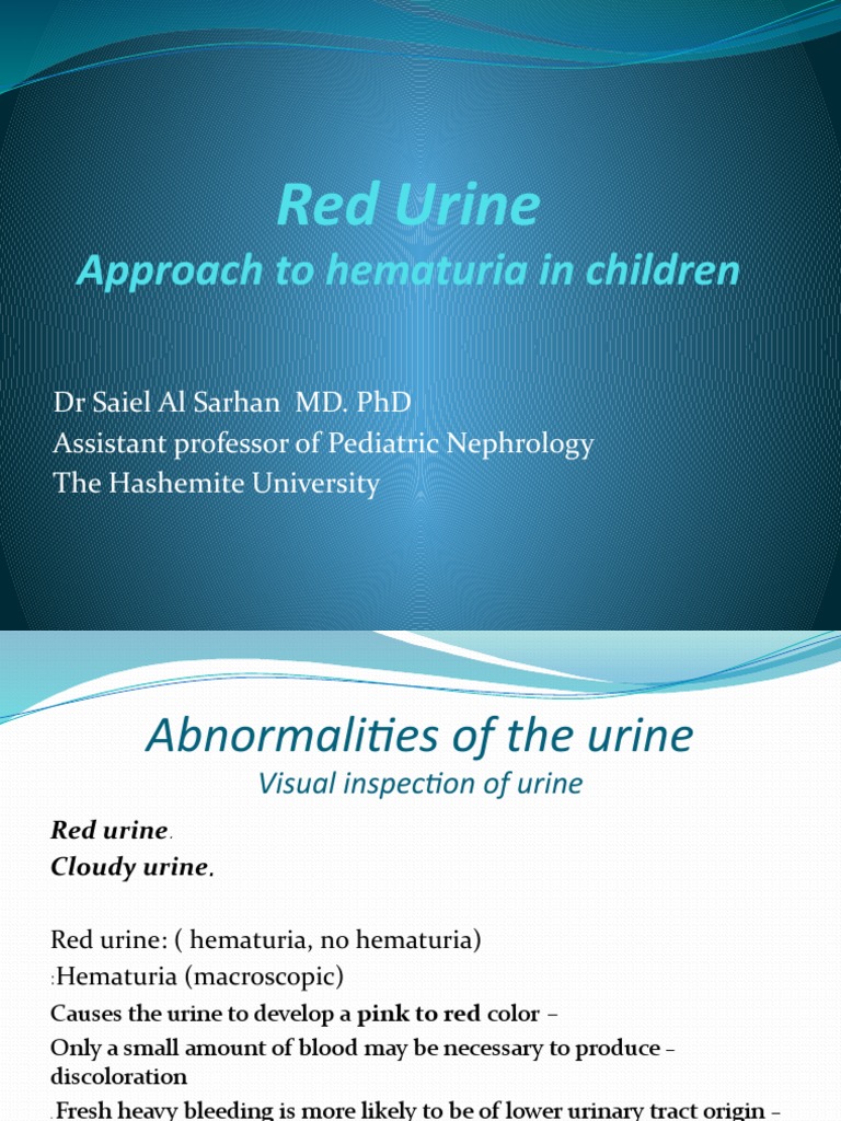 Red Urine: Approach To Hematuria in Children | PDF | Medical ...