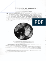Proyecciones RX de Oído y Mastoides | PDF | Oído | Otología
