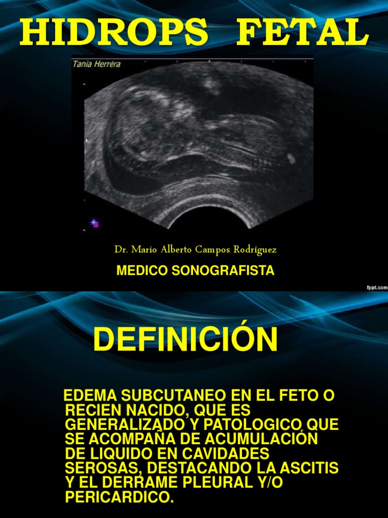 3 Hidrops PDF | PDF | Rtt | Especialidades Medicas