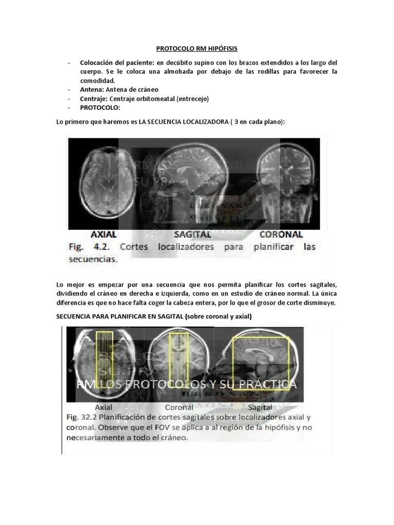 Protocolo RM Hipófisis | PDF