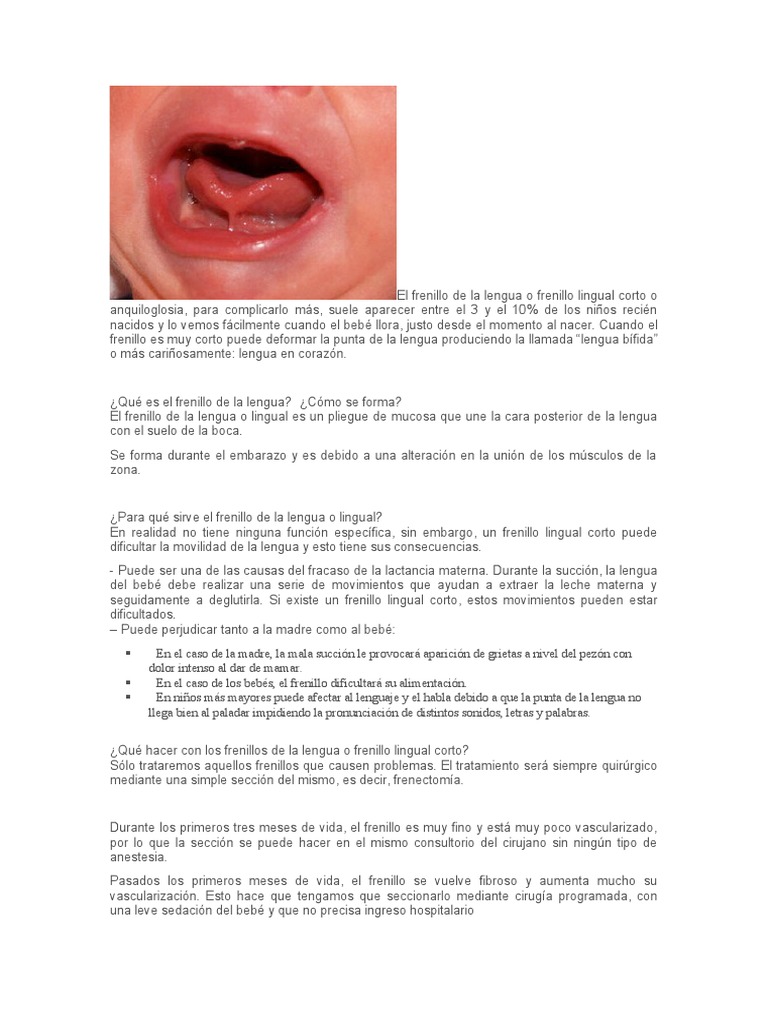 El Frenillo de La Lengua o Frenillo Lingual Corto o Anquiloglosia | PDF