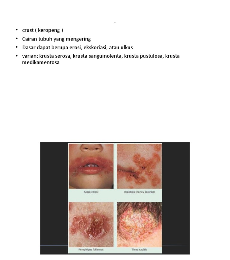 KRUSTA | PDF