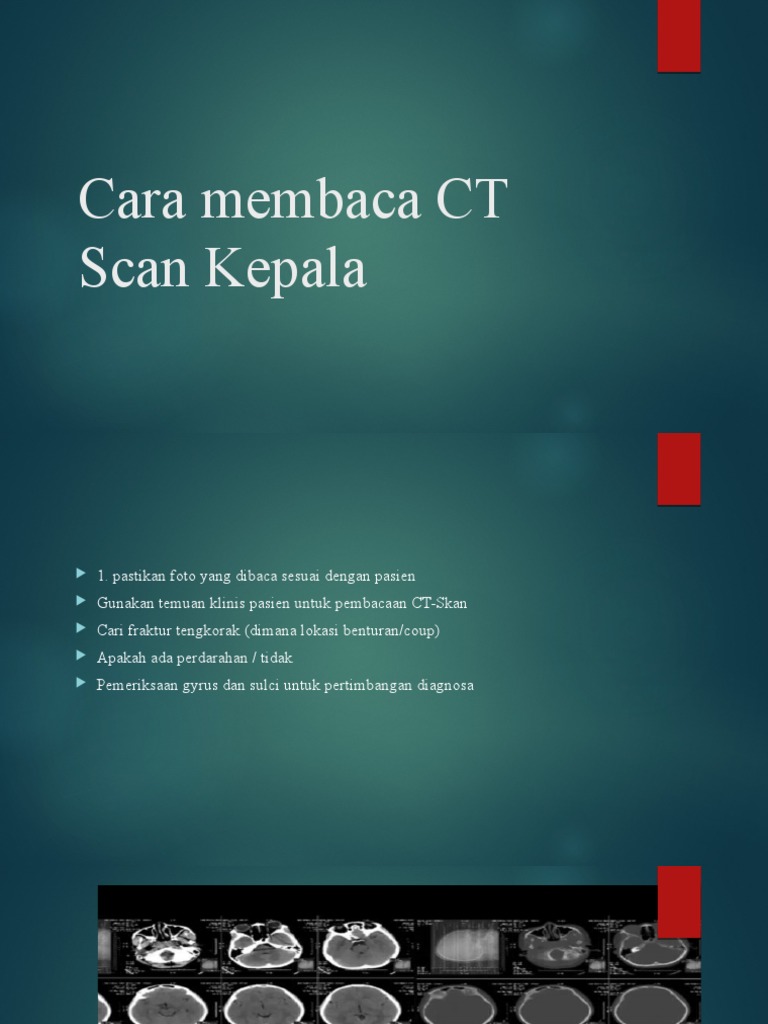 Cara Membaca CT Scan Kepala | PDF