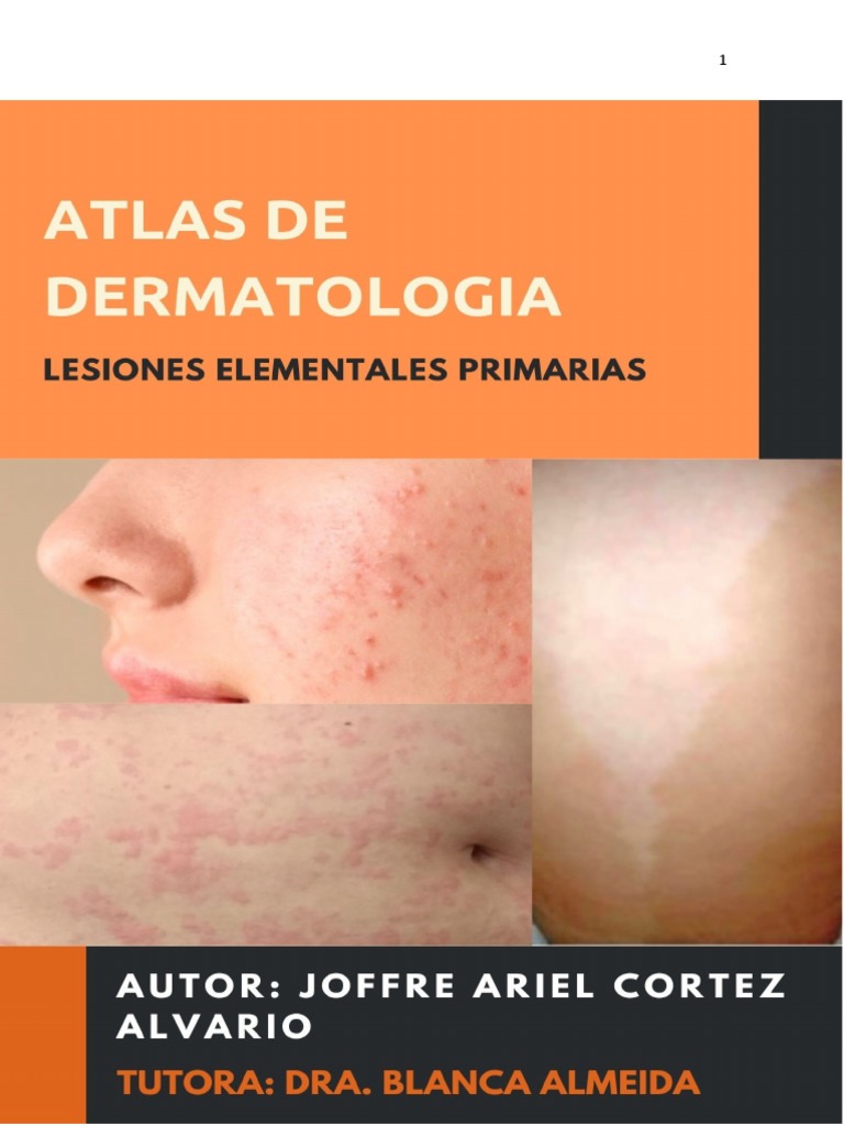 Atlas de Dermatologia | PDF