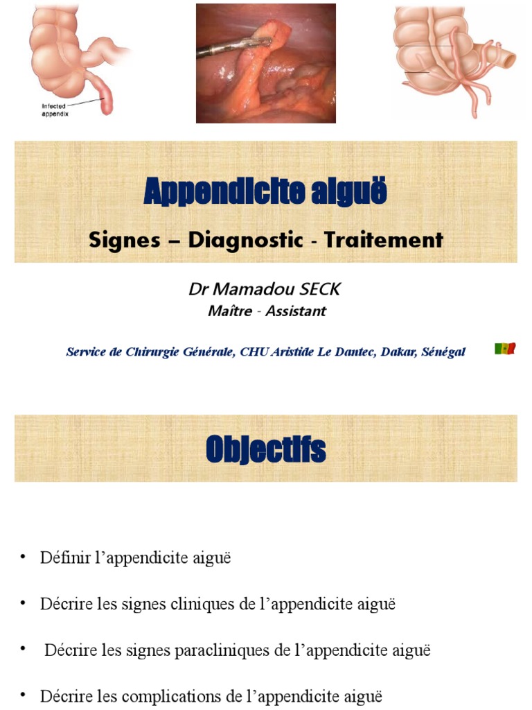 Appendicite Aiguë - Copie | PDF | Médecine clinique | Spécialités médicales
