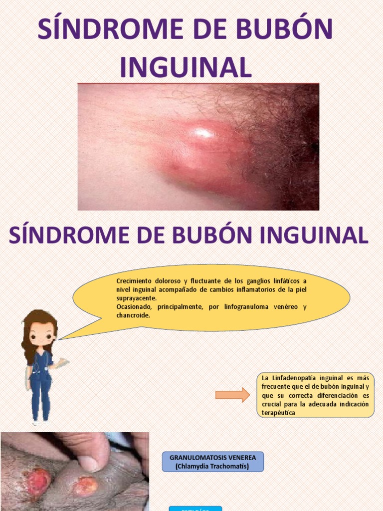 SD de Bubón Inguinal | PDF | Salud pública | Ciencias de la Salud