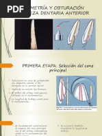 Tecnica de Step Back en Endodoncia | PDF