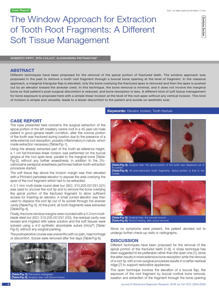 The Window Approach For Extraction of Tooth Root Fragments: A DifSoft ...