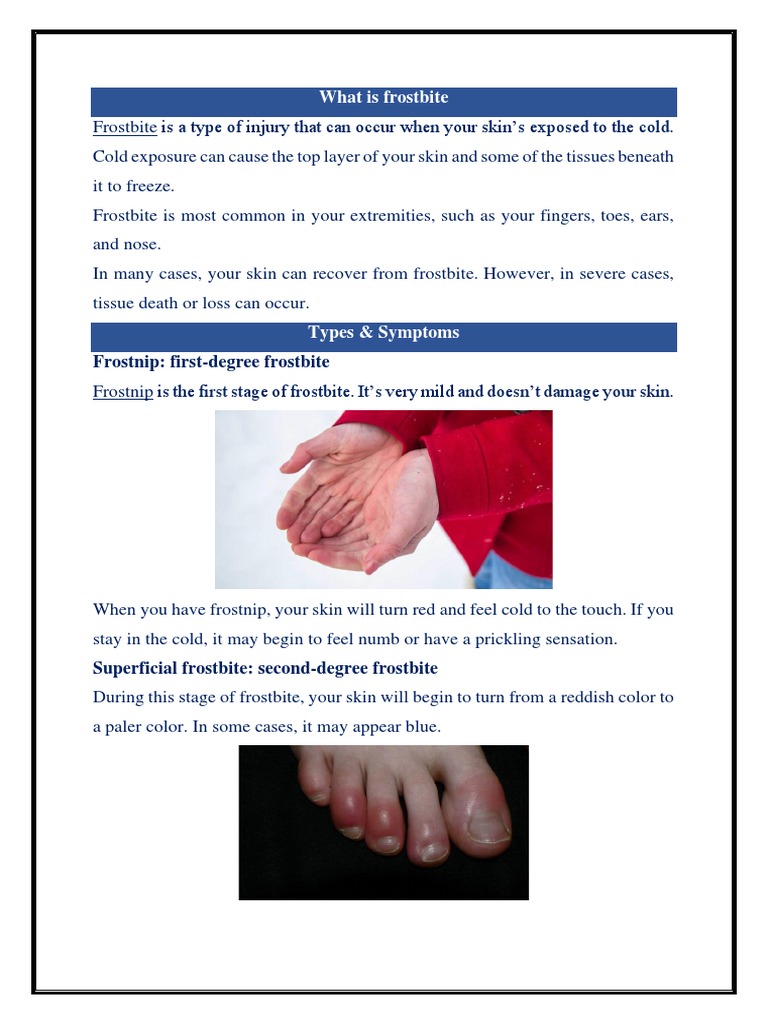 What Is Frostbite | PDF | Hypothermia | Rtt