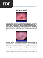 Colposcopia Normal | PDF | Epitelio | Membrana mucosa