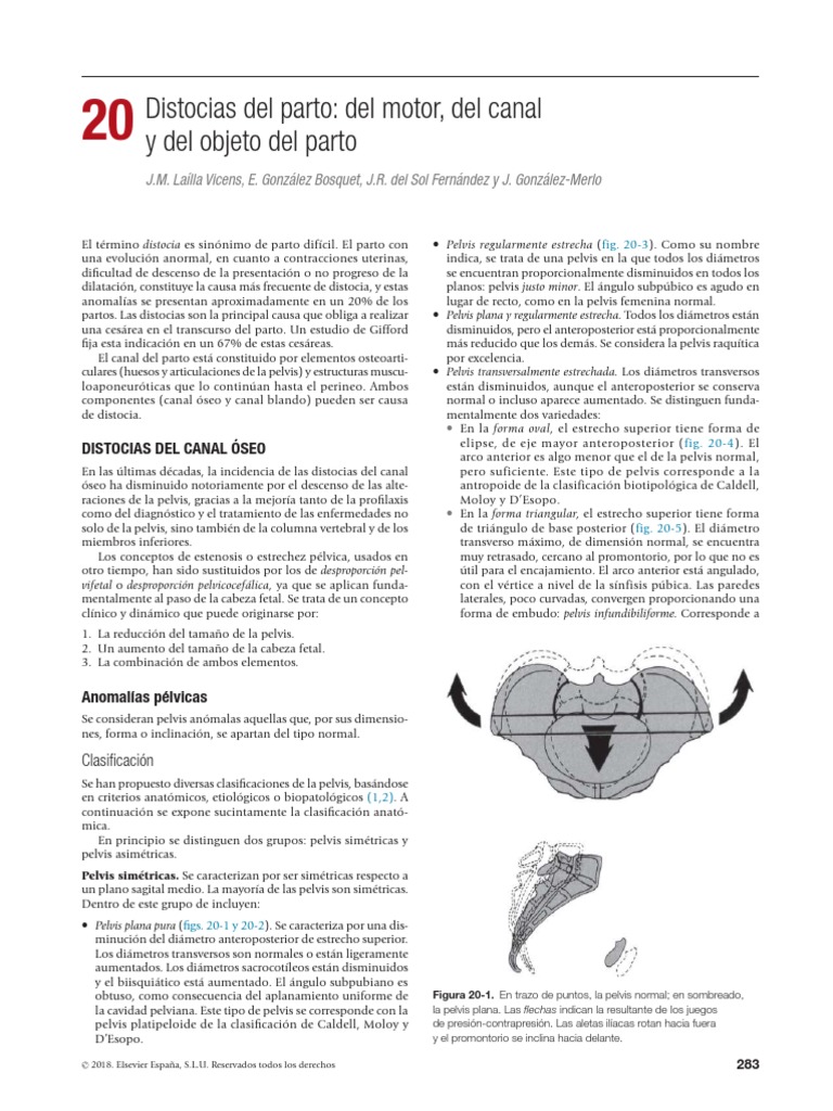 20 Distocias Del Parto - Del Motor, Del Canal y Del Objeto Del Parto ...