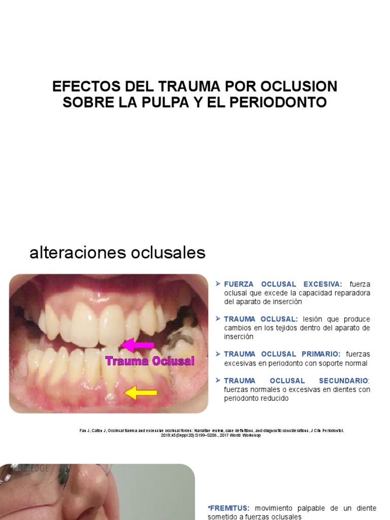 Efectos del Trauma Oclusal en Periodonto | PDF | Lesión | Odontología