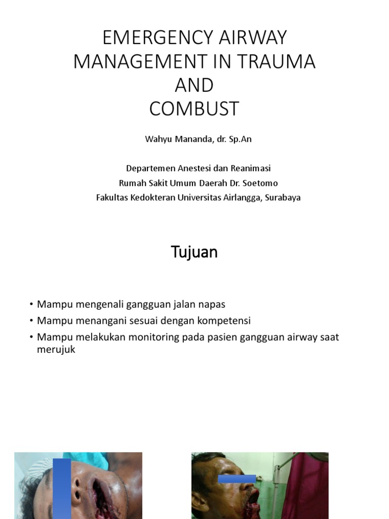 Emergency Airway Management in Trauma and Combust PDF | PDF