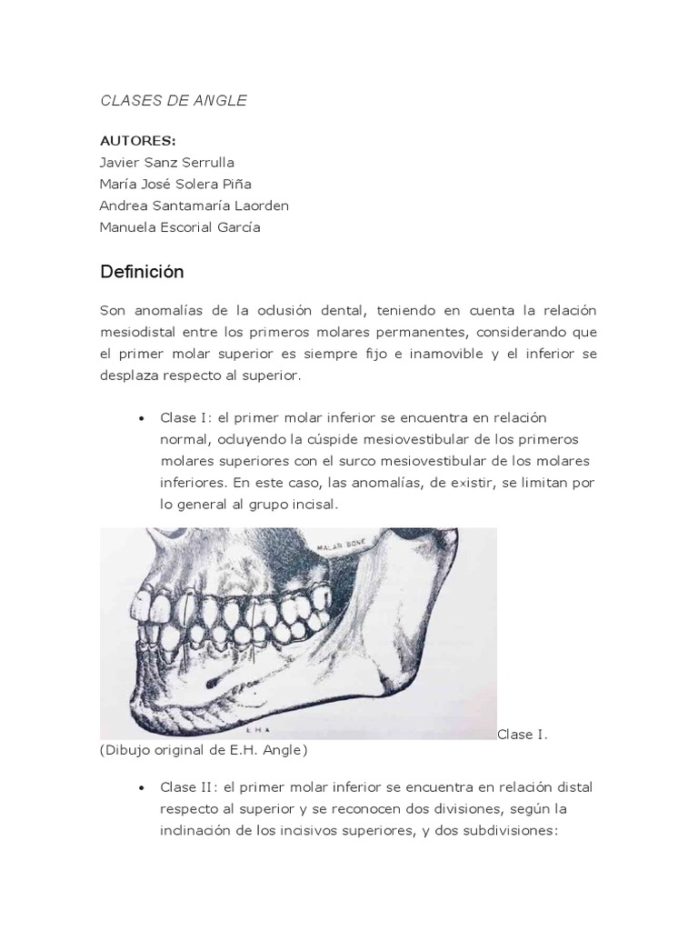 Clases de Angle | PDF