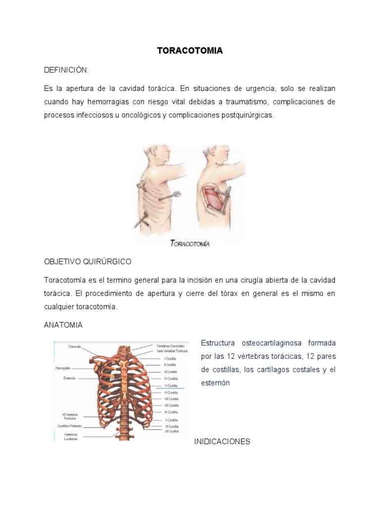 TORACOTOMIA | PDF | Biopsia | Especialidades Medicas