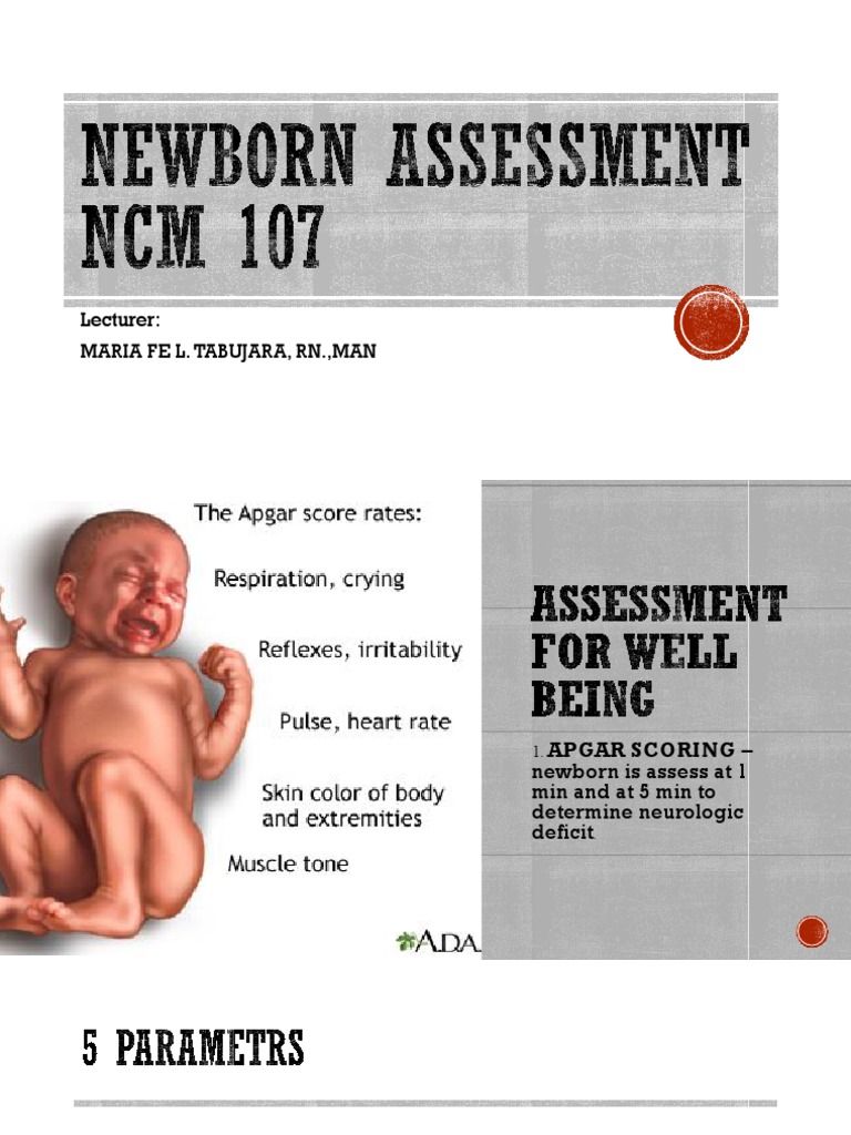 Assessment of the Newborn: Scoring Systems for Evaluating Gestational ...