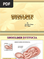 Zavanelli Procedure | PDF | Childbirth | Caesarean Section