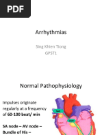 EKG Findings and Arrhythmias - USMLE Step 2 CK Exam | PDF | Cardiac ...