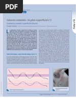 Types et techniques de points de suture | PDF | Suture (médecine ...