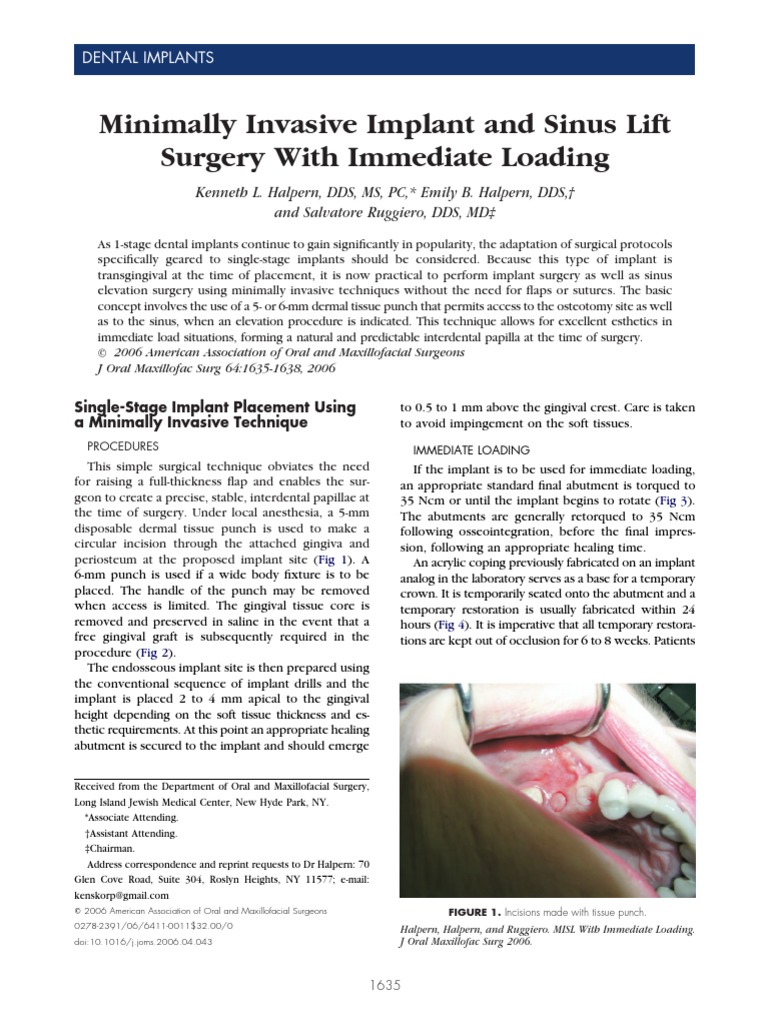 Minimally Invasive Implant and Sinus Lift Surgery With Immediate ...
