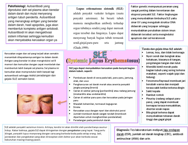 Mind Map Sle PDF | PDF