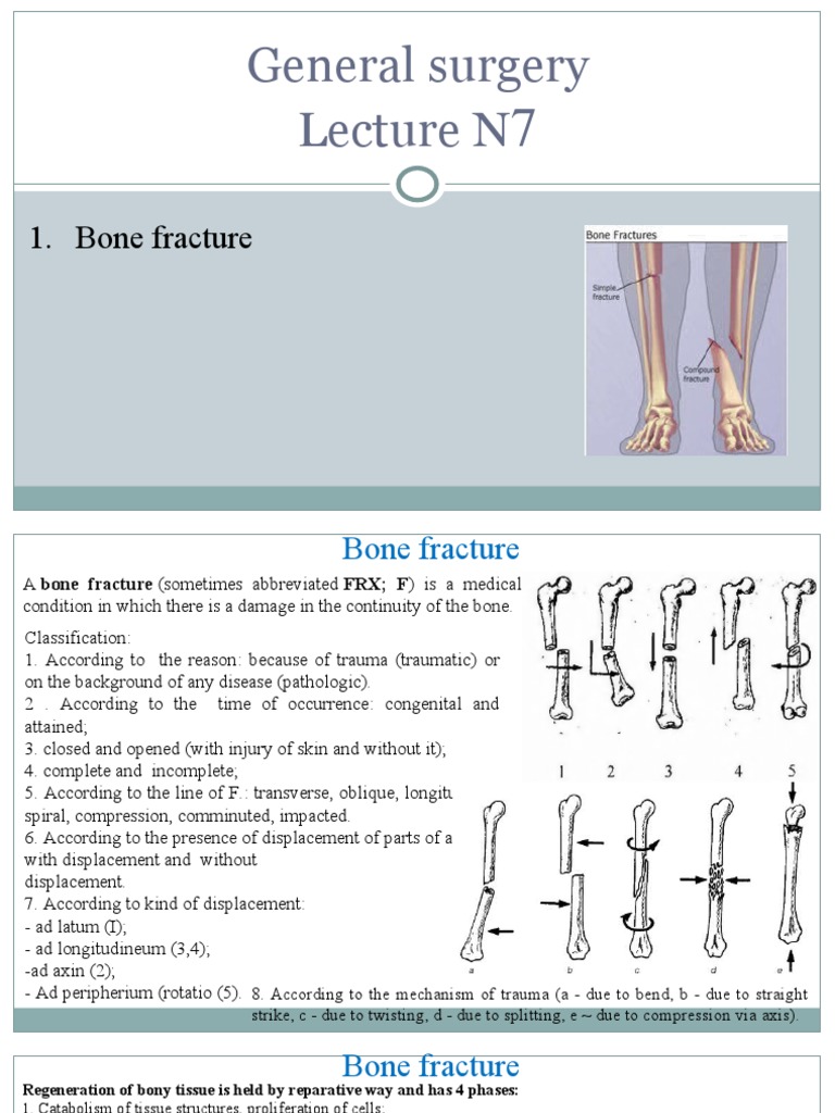 General Surgery Lecture N: 1. Bone Fracture | PDF | Bone | Medical ...