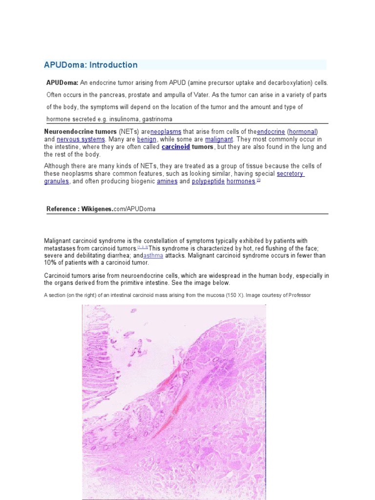 Apudoma: Introduction: Apudoma: An Endocrine Tumor Arising From Apud ...