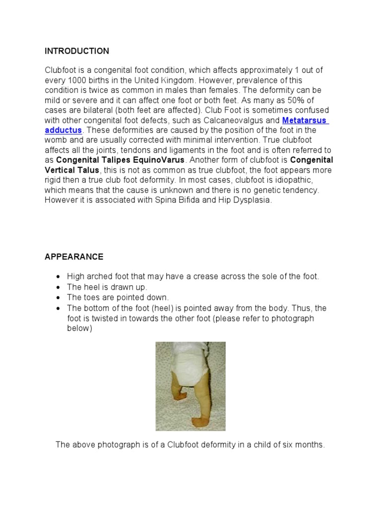 CLUB Foot | PDF | Foot | Diseases And Disorders