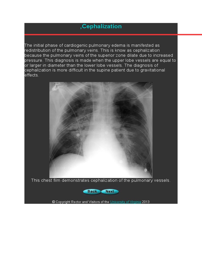 ,cephalization: University of Virginia | PDF