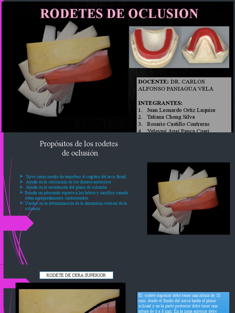 Rodete Oclusion | PDF | Naturaleza