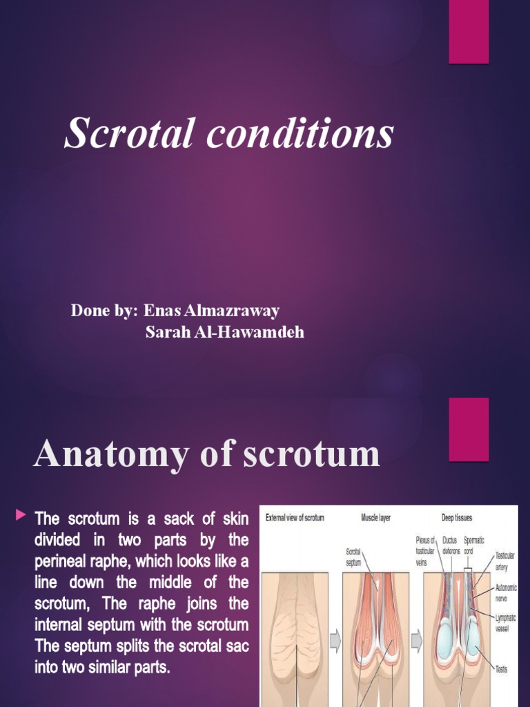 Scrotal Conditions: Done By: Enas Almazraway Sarah Al-Hawamdeh | PDF ...