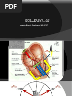 EKG Pocket Guide | PDF | Cardiac Electrophysiology | Electrocardiography