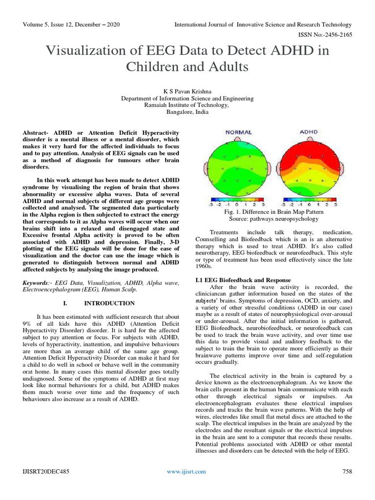 Visualization of EEG Data To Detect ADHD in Children and Adults ...