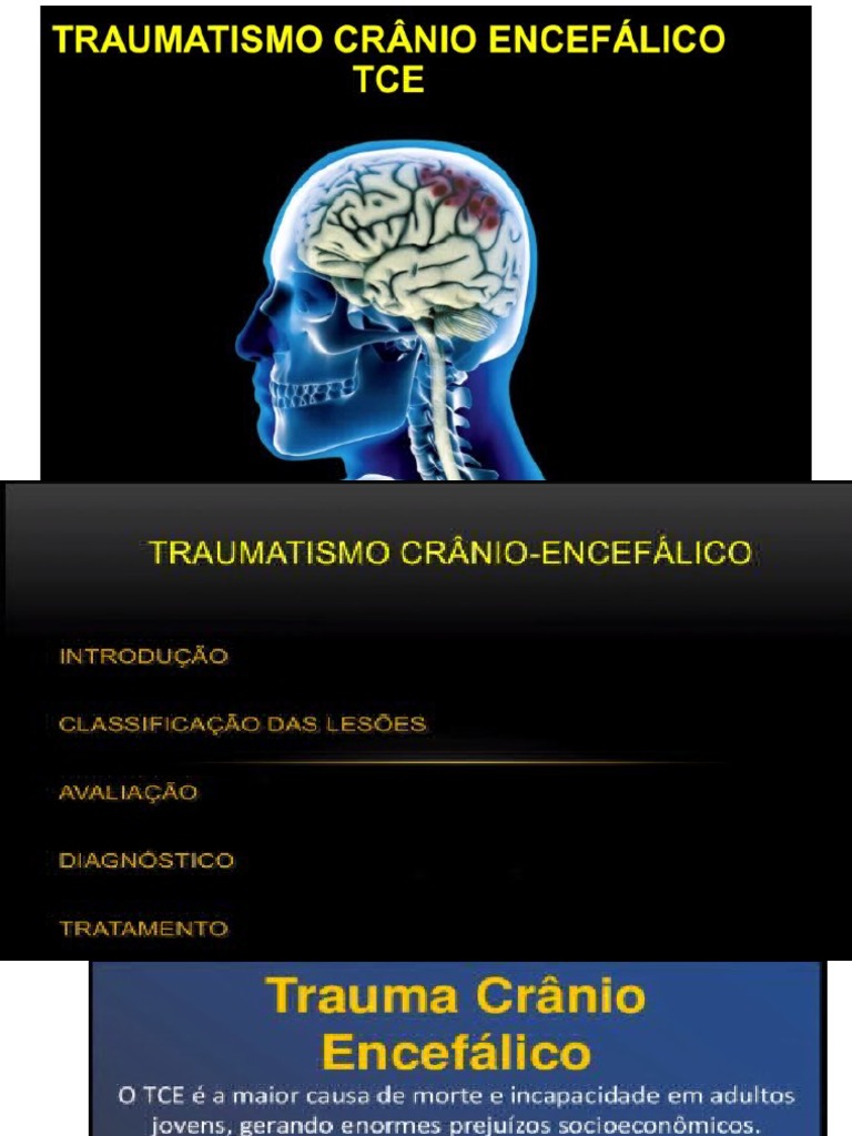 Aula 02 - Tce | PDF | Líquido cefalorraquidiano | Traumatismo craniano