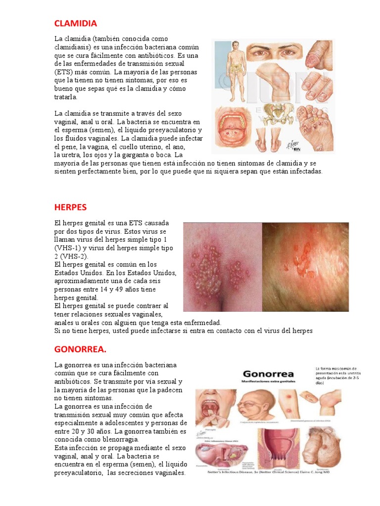 CLAMIDIA | PDF | Infección transmitida sexualmente | Herpes Simple