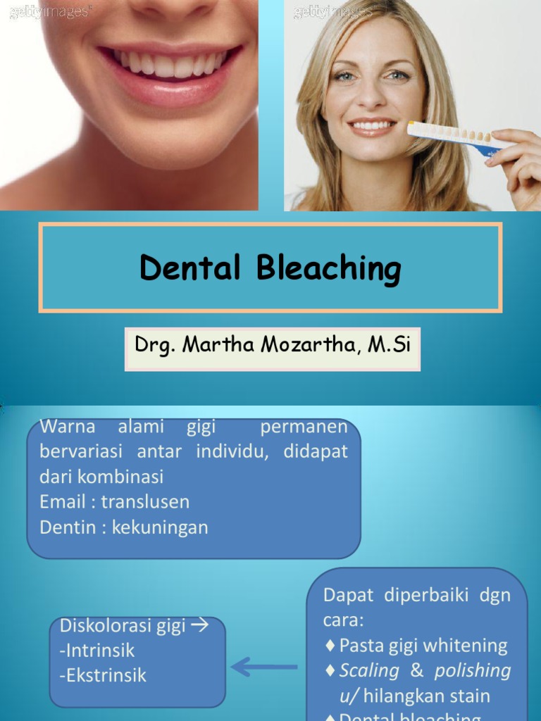 Diskolorasi Gigi Dan Prosedur Bleaching Bahan Kuliah | PDF