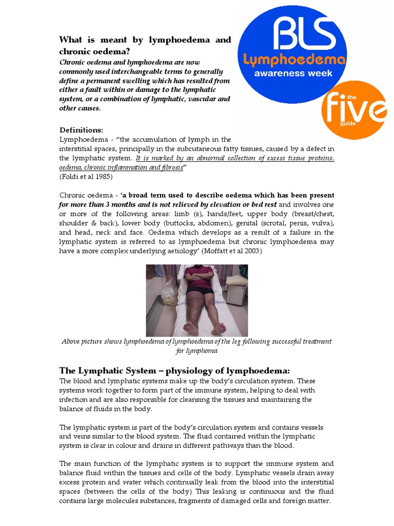 Understanding Lymphoedema: Defining the Condition, Exploring the ...
