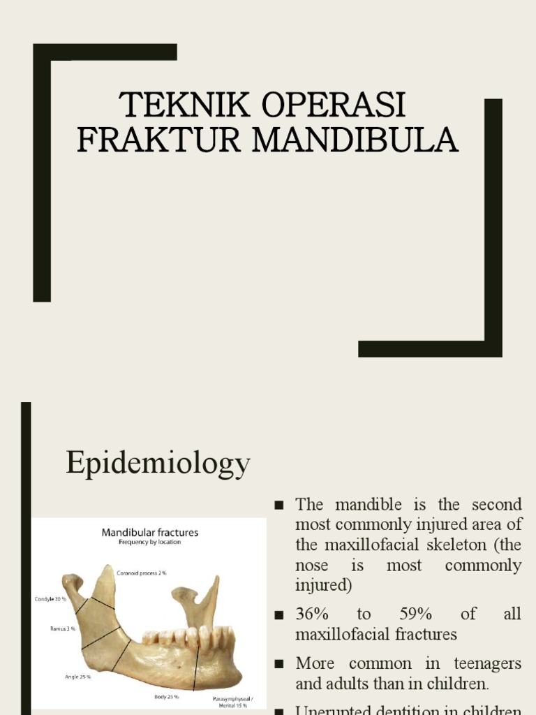 Teknik Operasi Fraktur Mandibula | PDF | Medical Specialties | Clinical ...