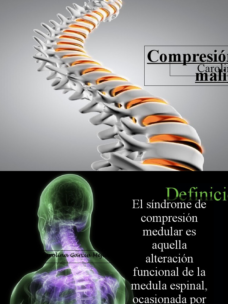 Compresión Medular | PDF | Especialidades Medicas | Medicina CLINICA
