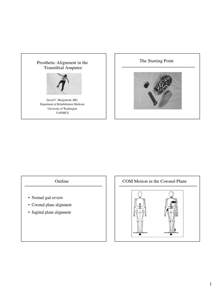 Prosthetic Alignment: The Starting Point | PDF | Anatomical Terms Of ...
