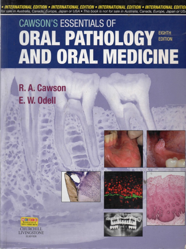Cawson's Essentials of Oral Pathology and Oral Medicine | PDF