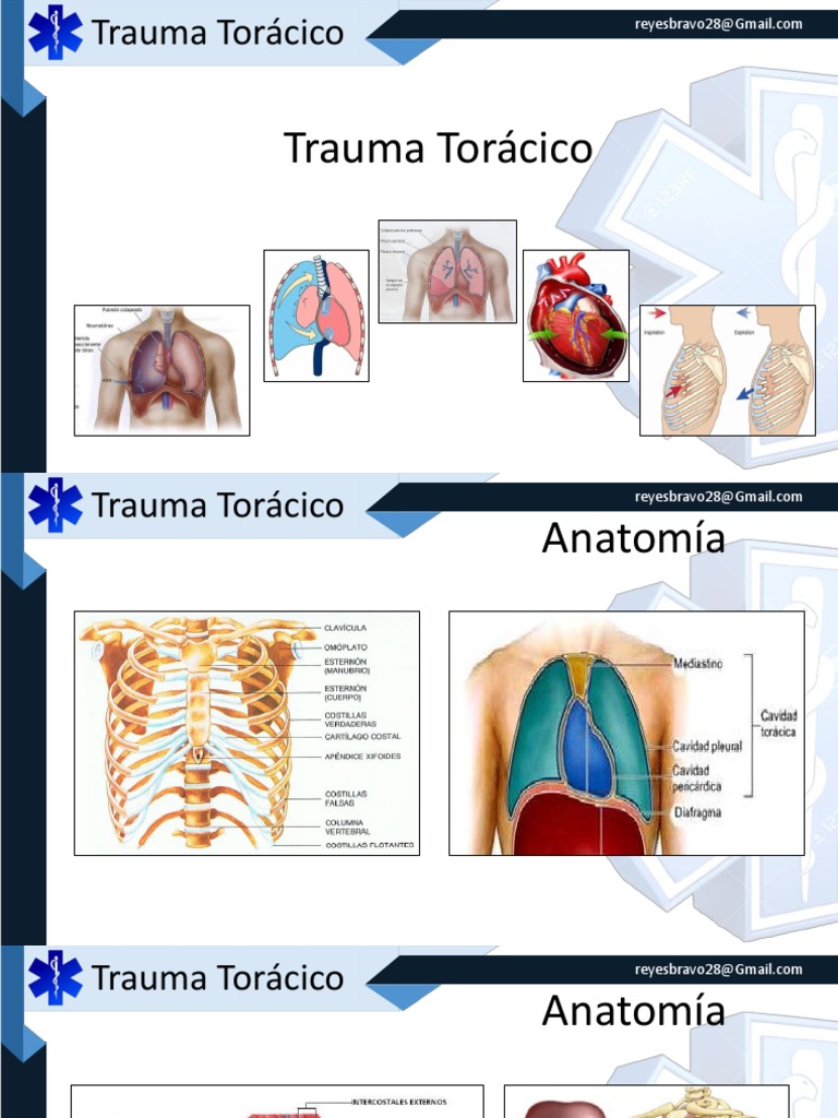 Trauma Toracico | PDF | Tórax (anatomía humana) | Emergencias Médicas