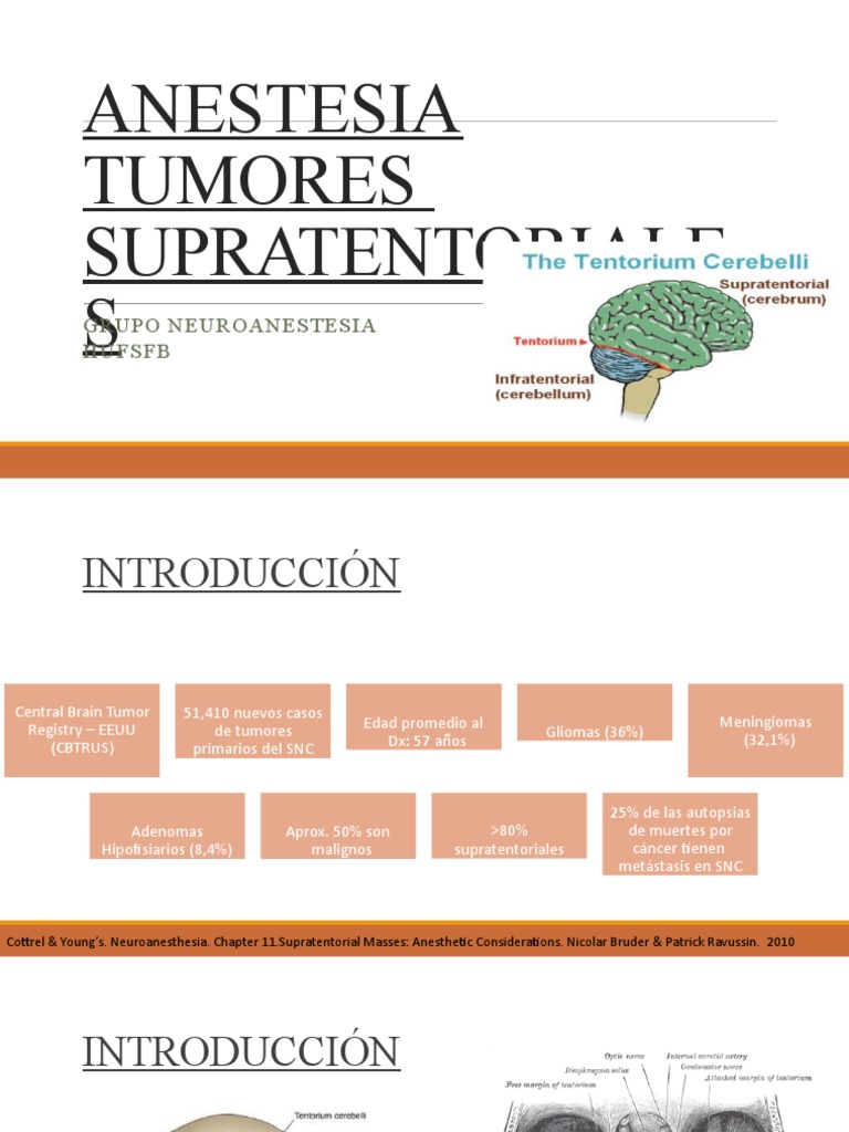 Anetesia Tumores Supratentoriales | PDF | Fluido cerebroespinal | Glioma
