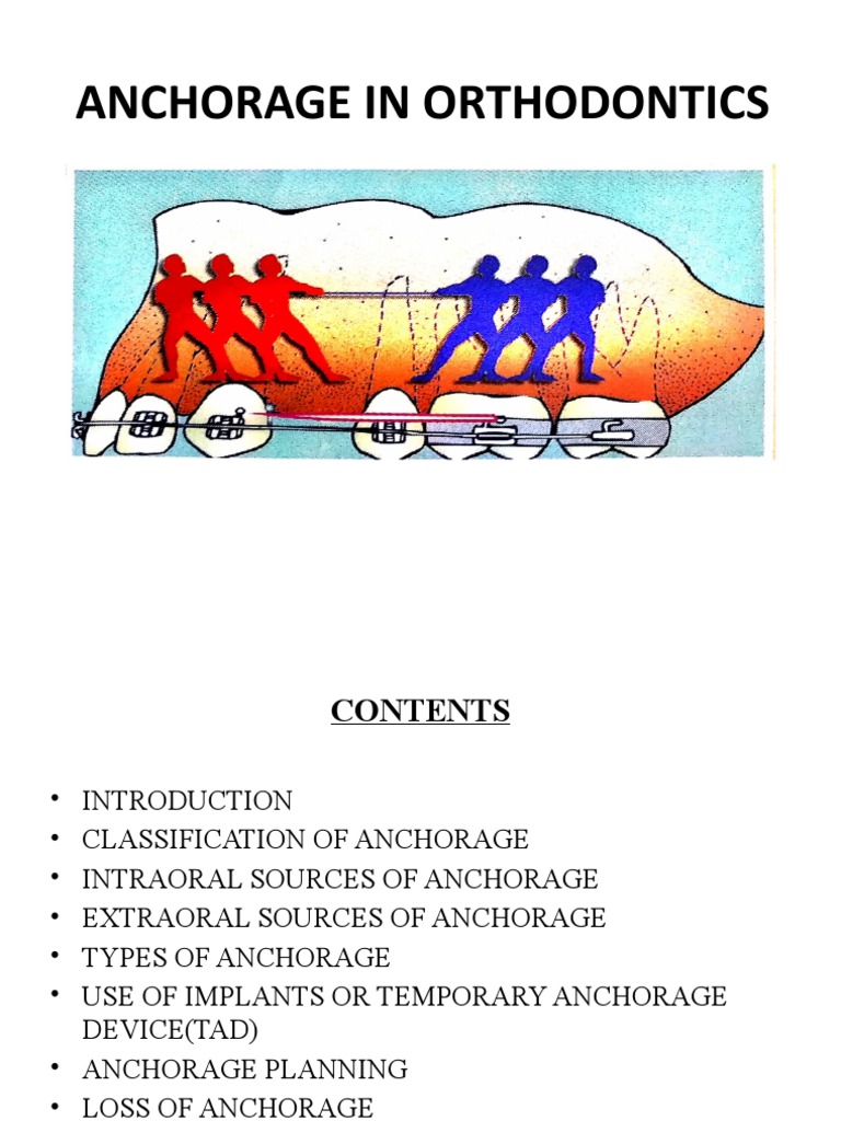 Anchorage Types and Planning in Orthodontics | PDF | Mouth | Dentistry