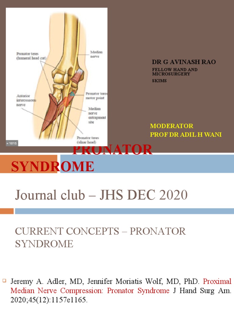 Pronator Syndrome: DR G Avinash Rao | PDF | Carpal Tunnel Syndrome ...