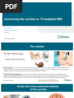Prostate Fossa Contouring Guide | PDF | Prostate | Urinary Bladder