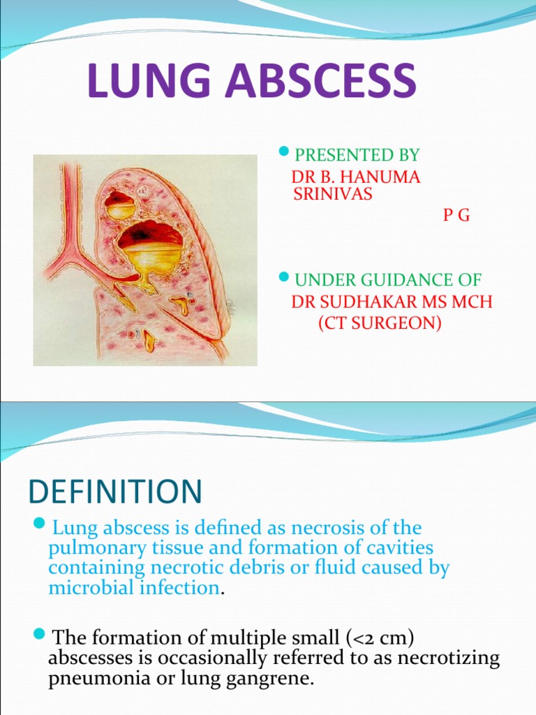 Lung Abscess: Presented by | PDF | Pneumonia | Infection