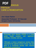 Understanding Your Dialysis Fistula | PDF | Hemodialysis | Medical ...