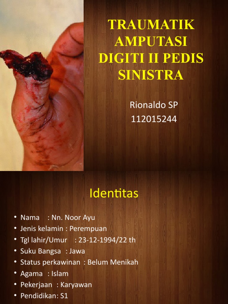 Traumatik Amputasi Digiti II Pedis Sinistra | PDF